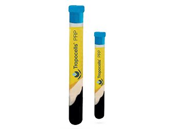 Tropocells PRP - סלע מדיקל - Sela Medical